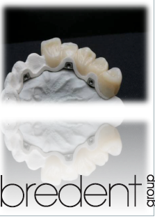 Materiales BioHPP - Implantes dentales y prótesis. Soluciones en ...