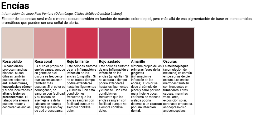 Dientes, encías y lengua: ¿cuál es su color? - Implantes dentales y ...