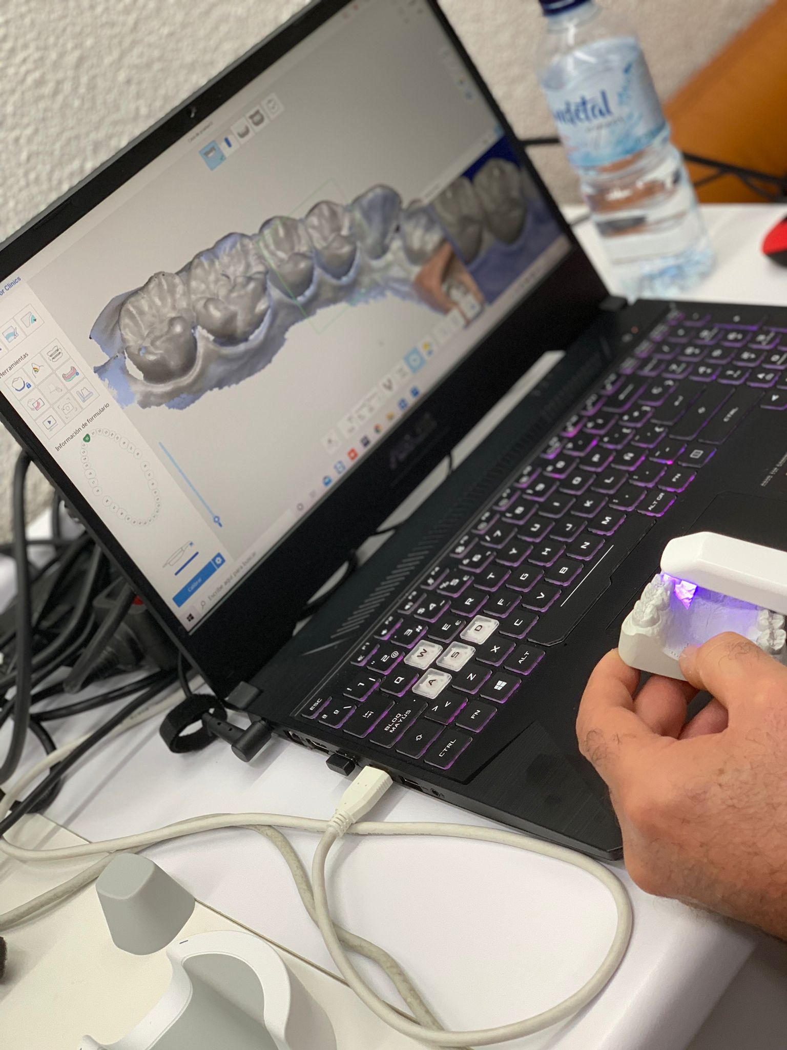 Formación Copa Sky - Implantes dentales y prótesis. Soluciones en ...